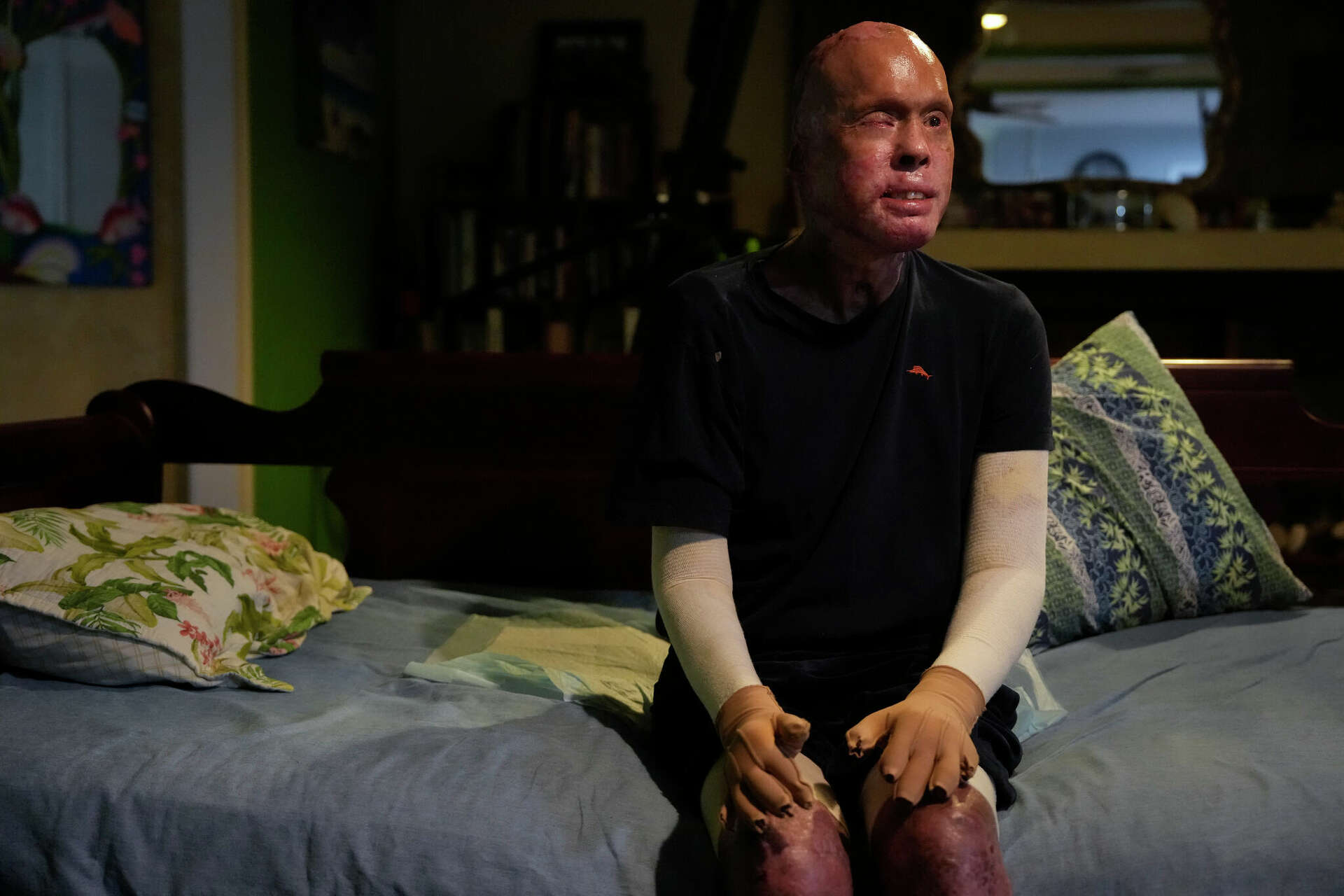 A faulty furnace. A blast of fire. And a man’s life, shattered