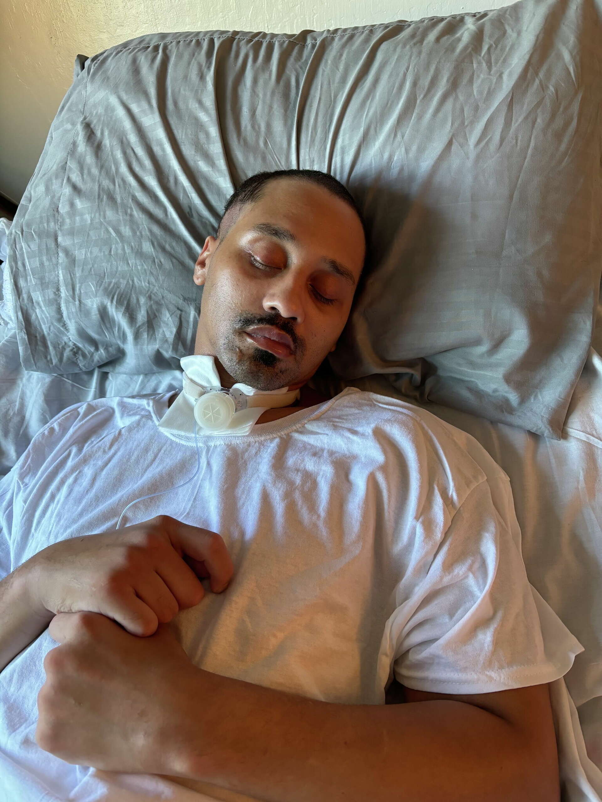 S.F. man tased by East Bay parks police left comatose, lawsuit claims