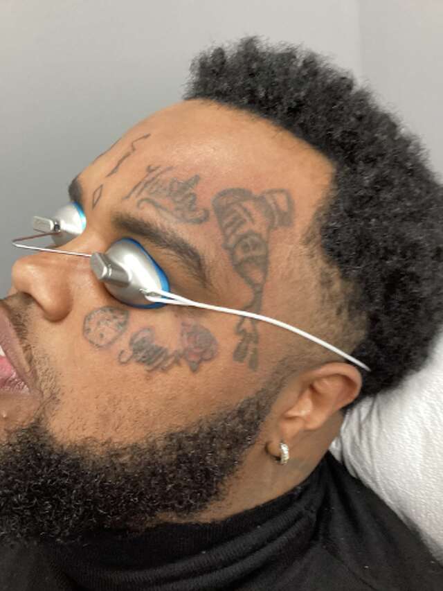 Tattoo removal company helping former CT gang member get into Yale