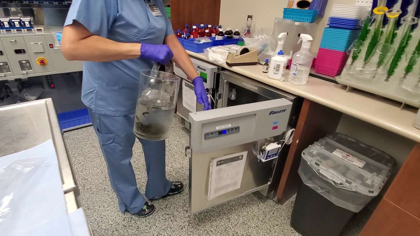 Leeches save severed fingers at Ben Taub hospital. Here's how.