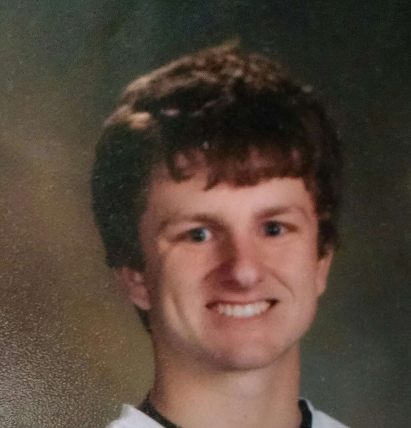 Derek Pfaff receives life-changing face transplant at Mayo Clinic