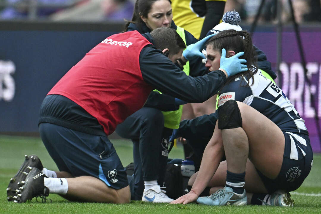 Ilona Maher breaks nose in pro rugby match, shows off on Instagram