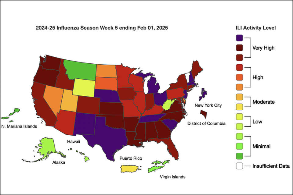 Experts: California seeing one of its worst flu spikes this century