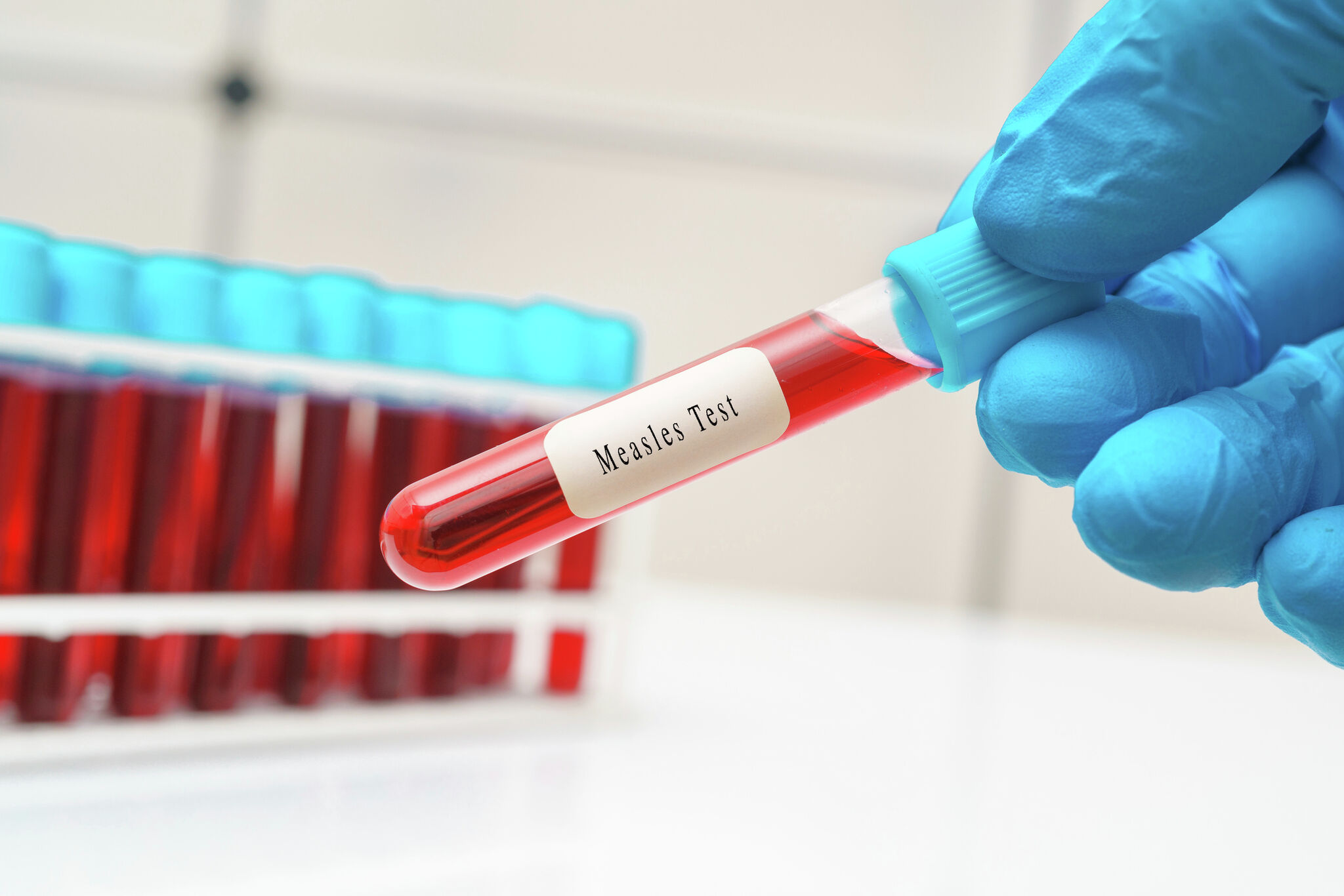 District Health Department #10 offers measles advice to West Michigan