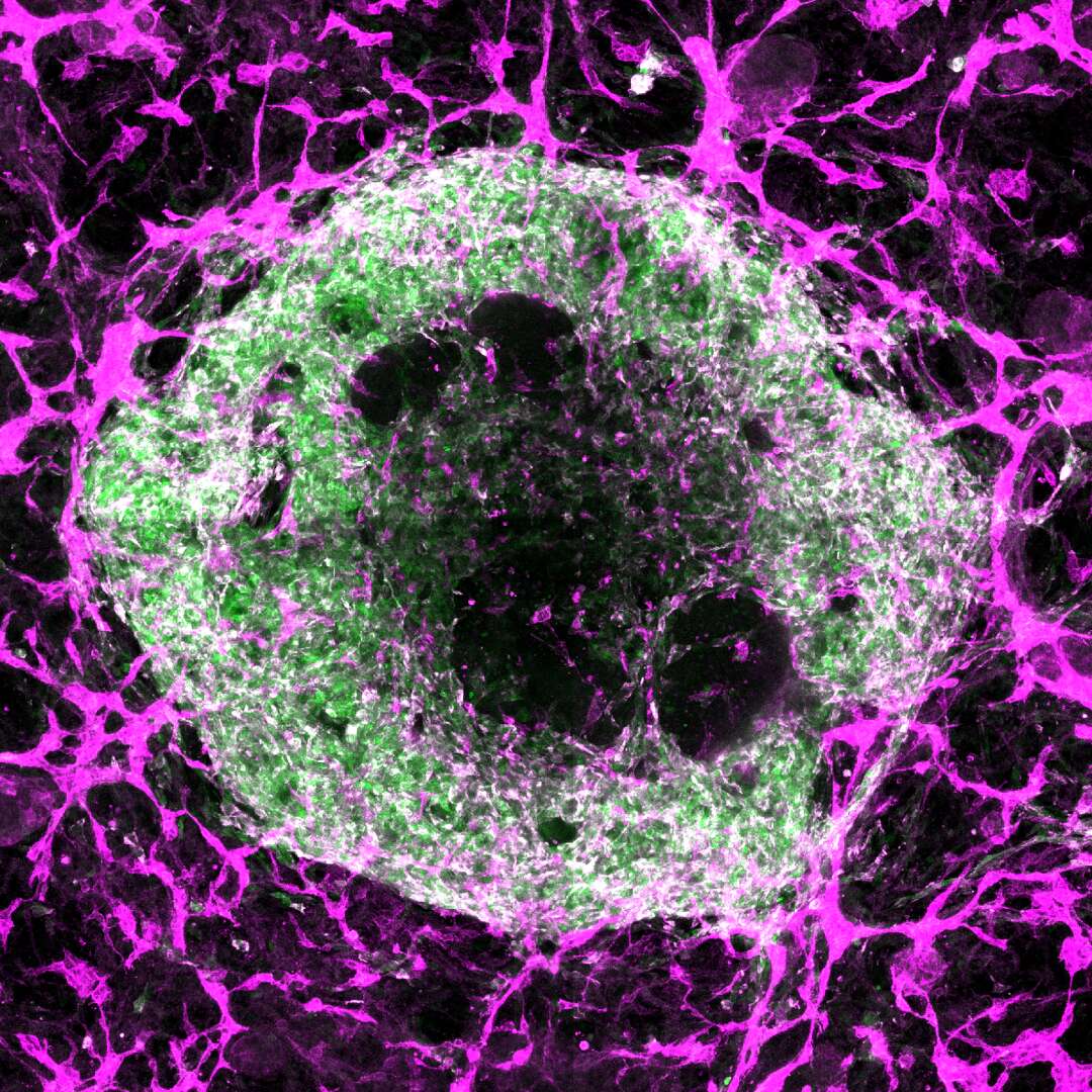 How Stanford mini-heart breakthrough could change medical research