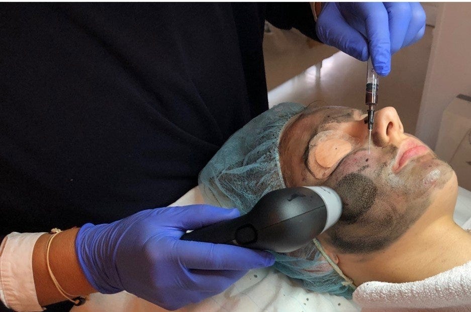 Could coating your skin in gold solve your acne problem?