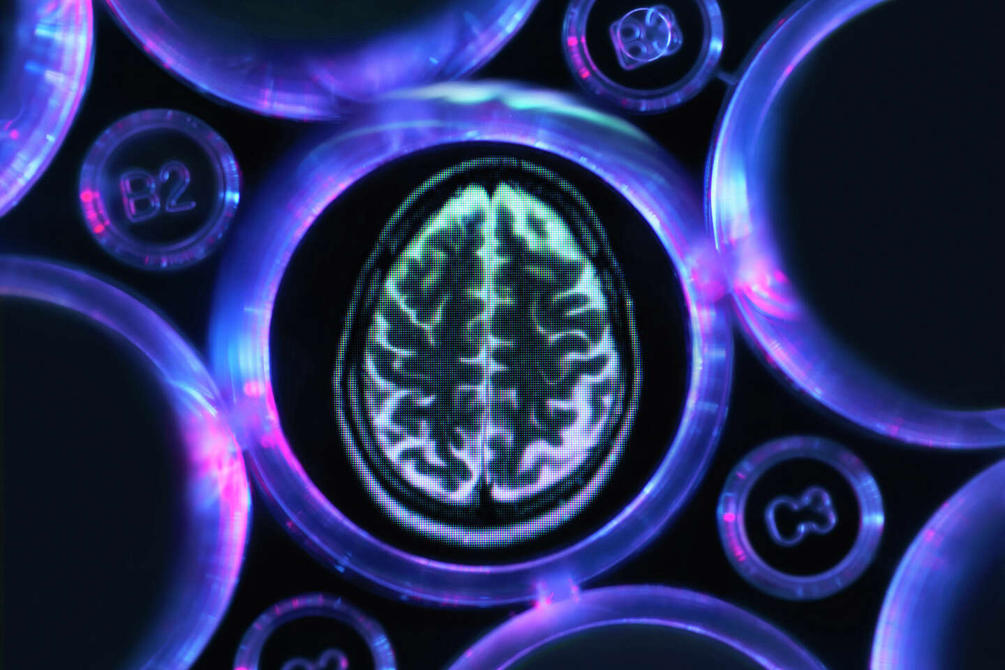 Is memory loss ‘normal’ aging or something worse? How to find out