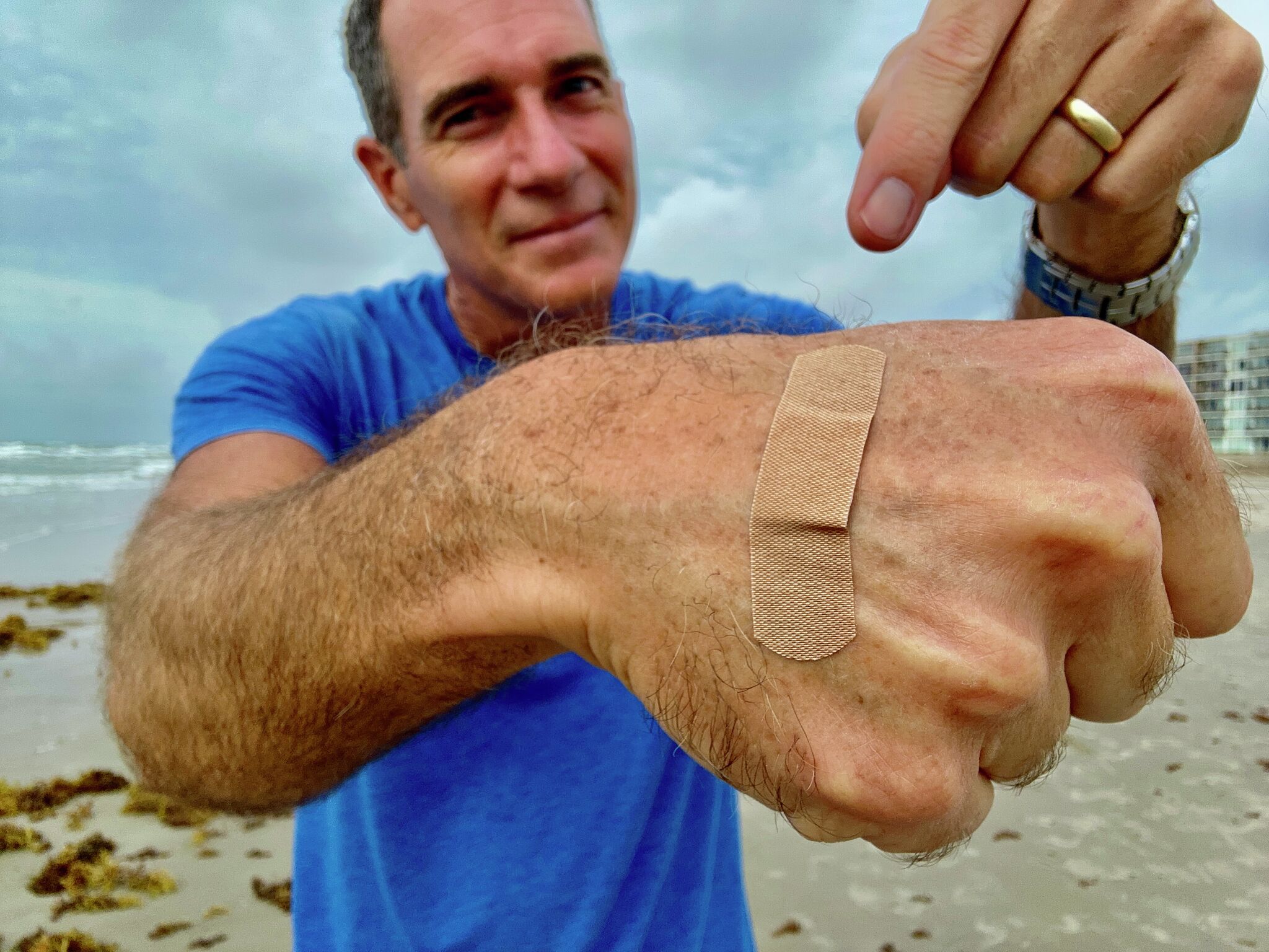 Don't let a flesh-eating bacteria ruin your tan at the beach