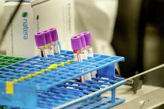 When will cancer return? Personalized Signatera blood test can find ...