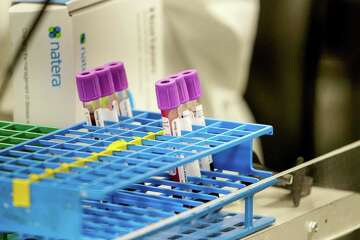 When will cancer return? Personalized Signatera blood test can find ...