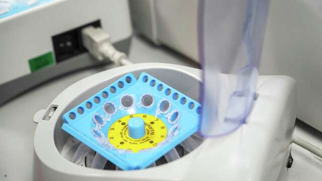 When will cancer return? Personalized Signatera blood test can find ...