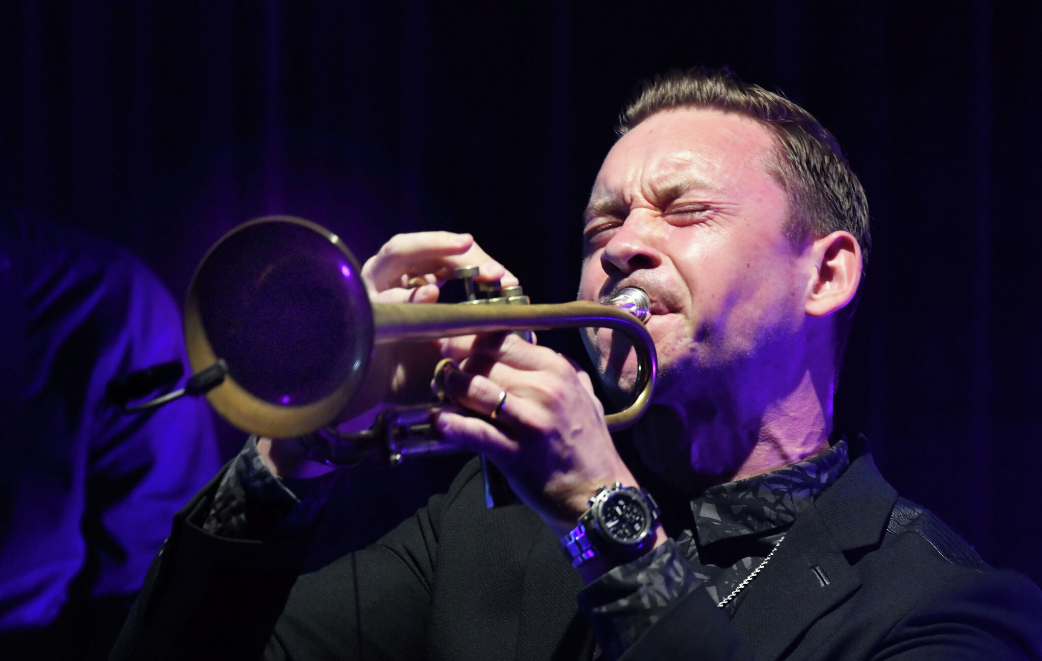 Trump is checked for swelling in legs and was diagnosed with a common ...