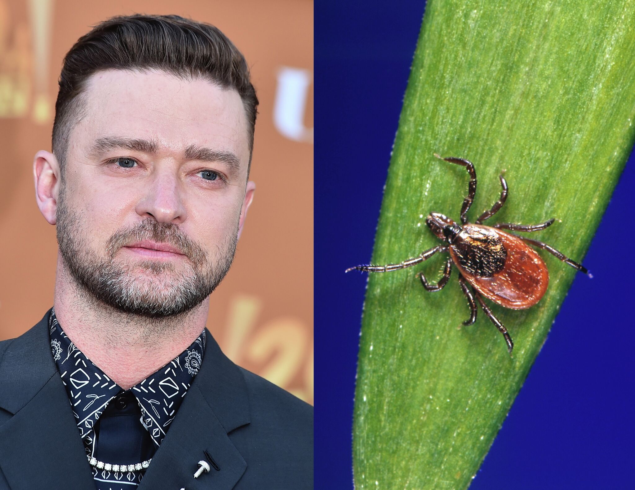 What is Lyme disease? What to know about Justin Timberlake's diagnosis