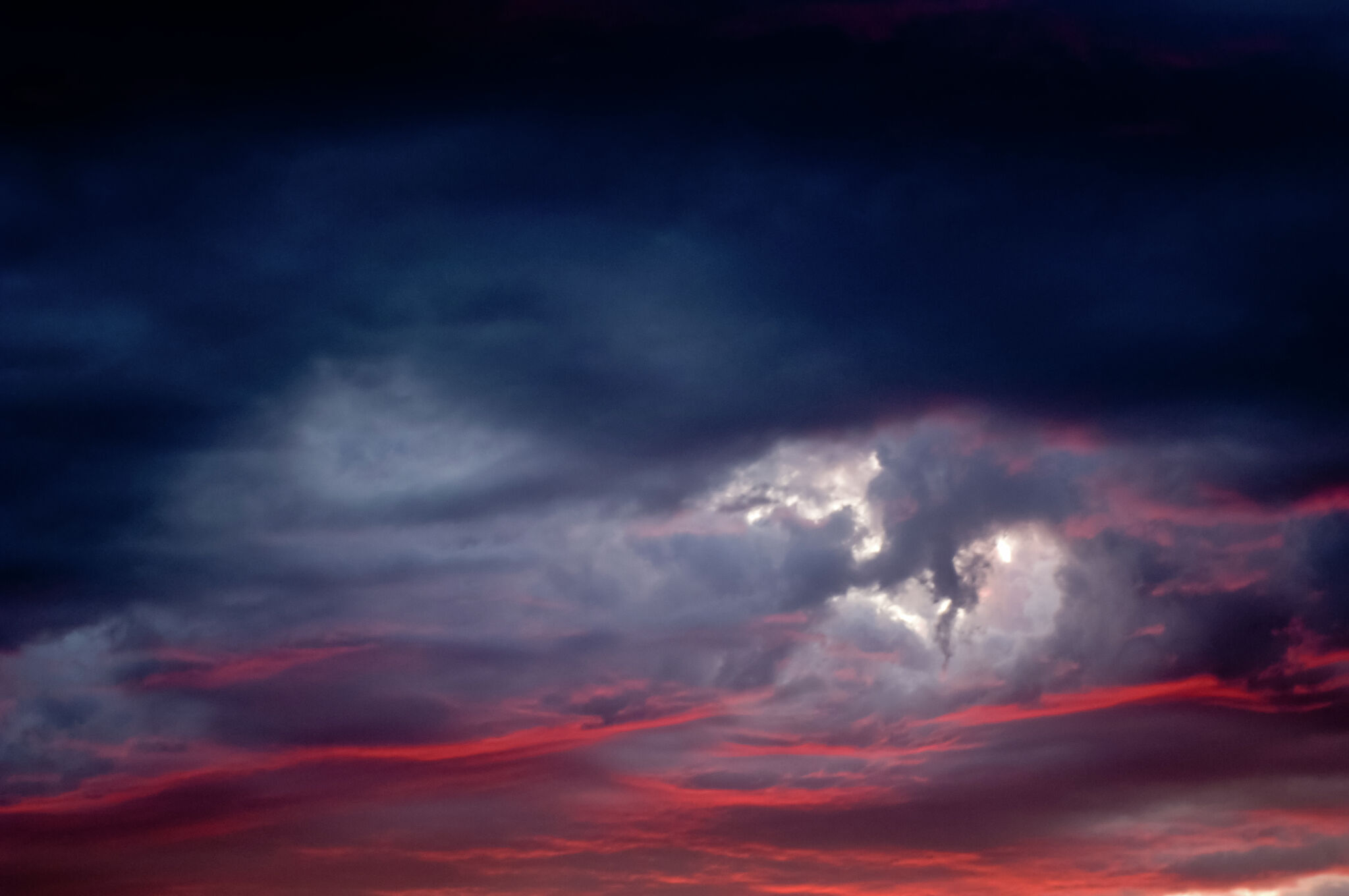 The CT man with no memory who changed neuroscience