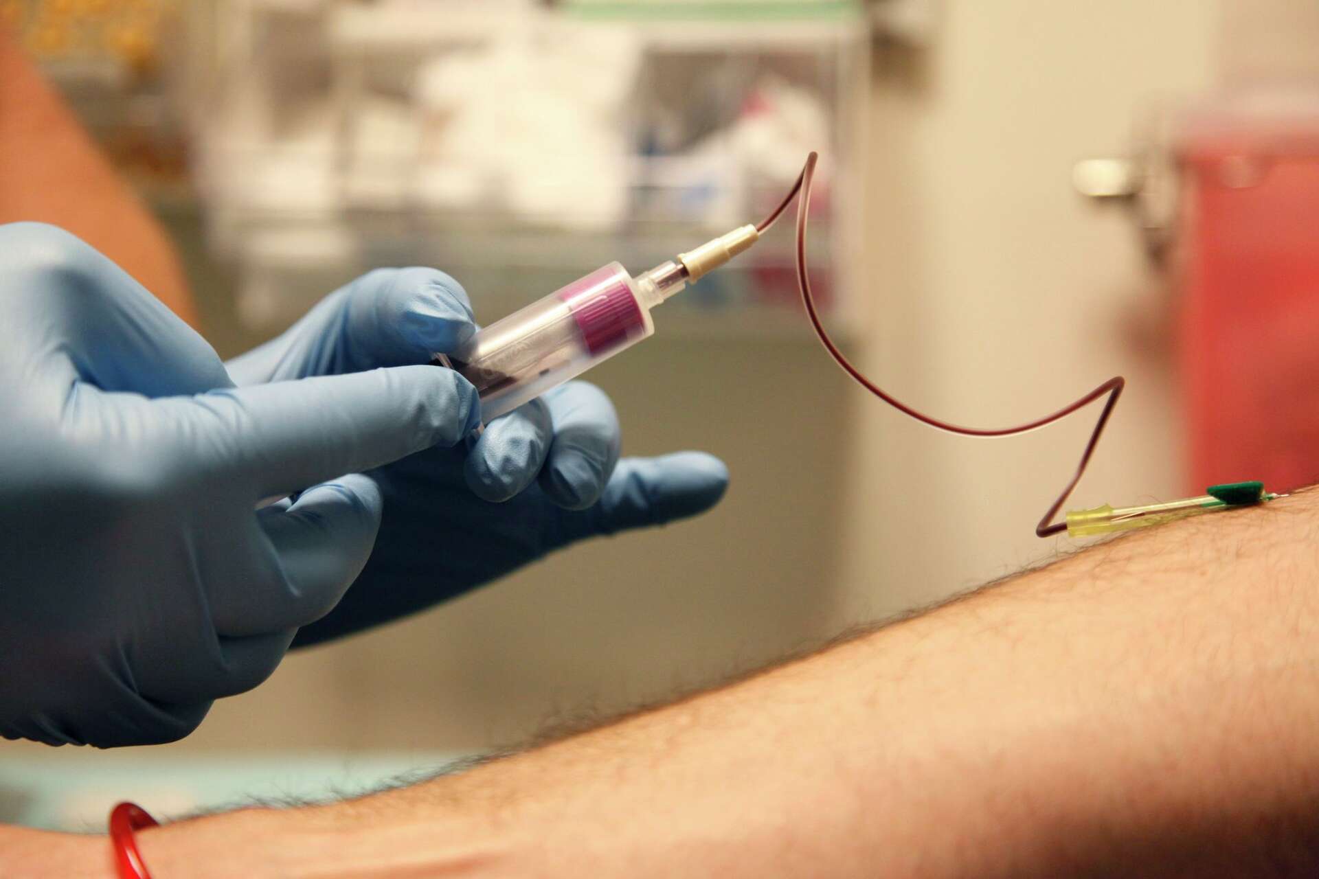 San Francisco HIV cases rise; report shows disparities