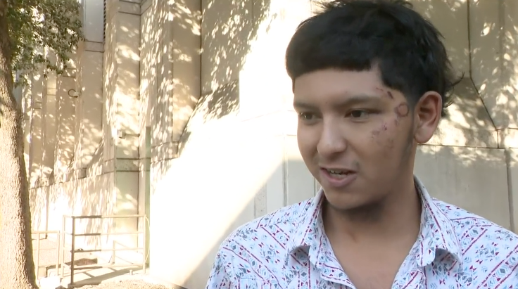Man punched in viral Austin police video faces felony assault charge
