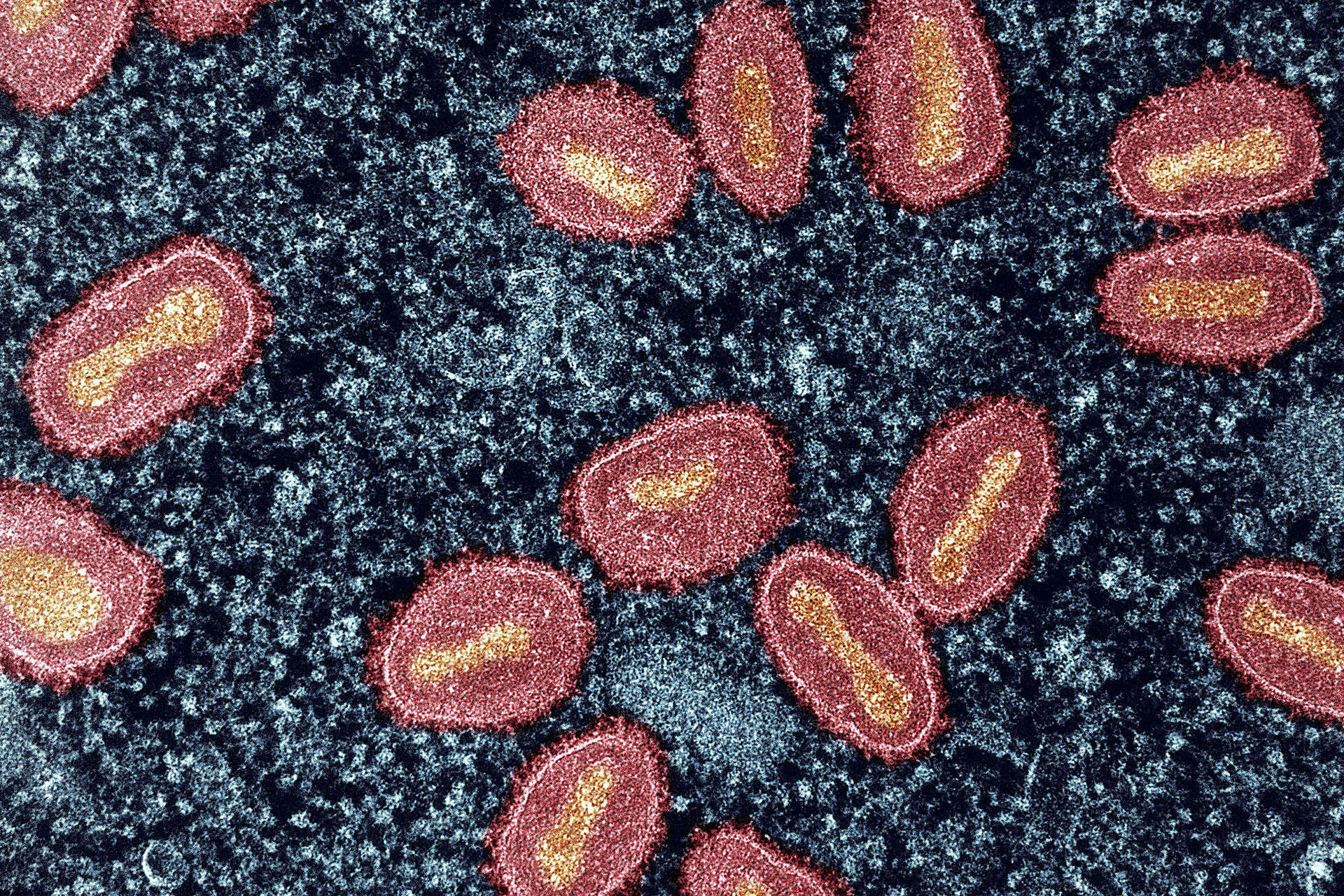 'Severe' rare virus strain potentially spreading in LA County