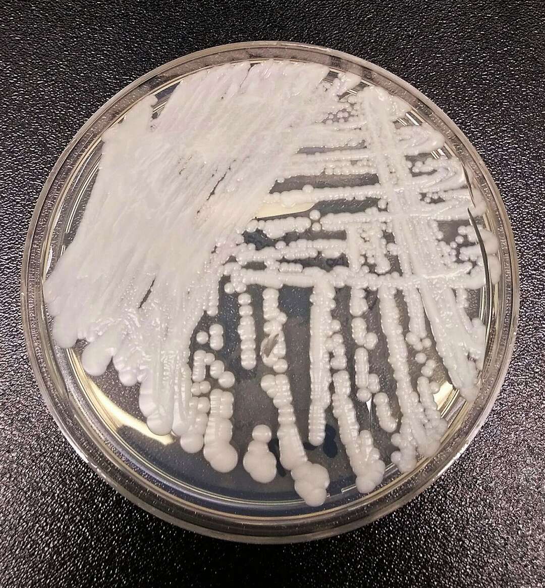 New 'super scary’ fungus already detected in Connecticut, experts warn
