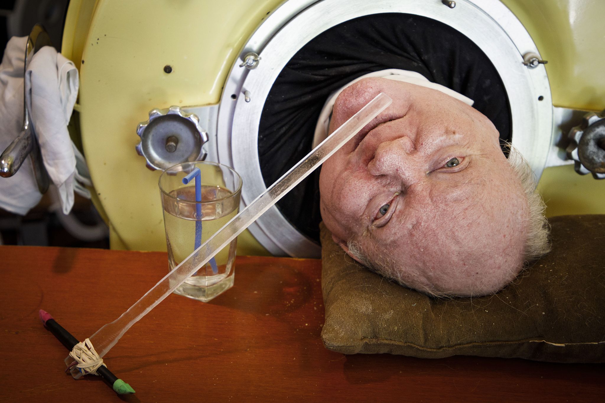 Iron lung survivor Paul Alexander was my childhood friend in Dallas