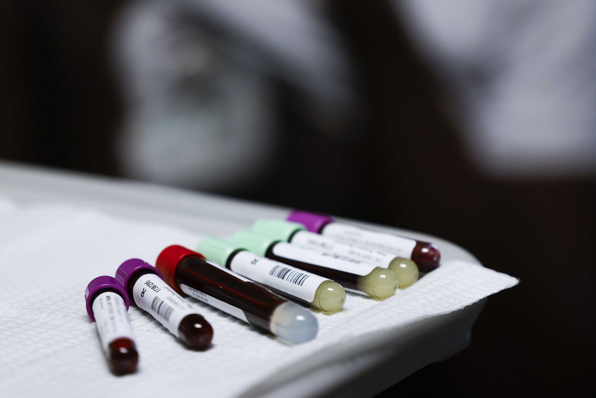 Gut microbe may help ease sickle cell pain, UT Dallas study finds