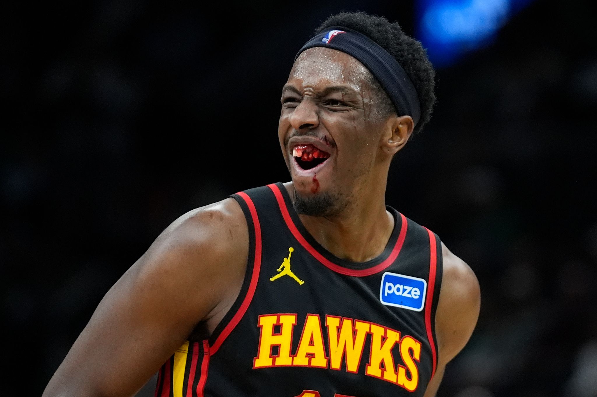 Onyeka Okongwu has a dental fracture after elbow to the face and will ...