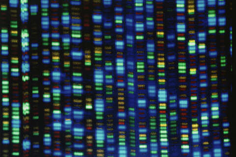 Studies test whether gene-editing can fix high cholesterol. For now ...