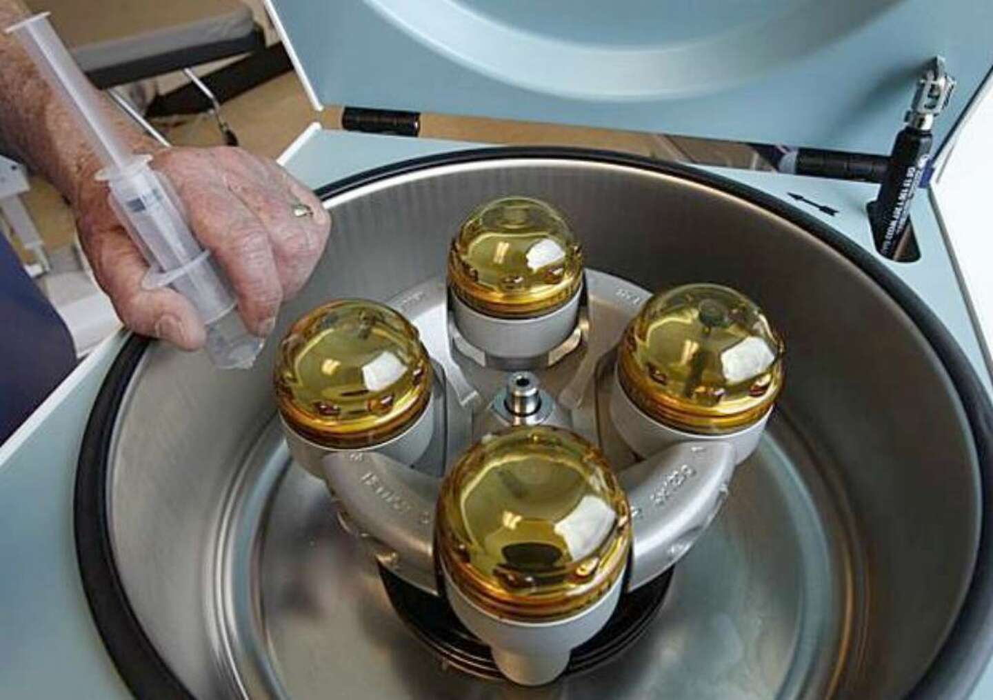 Blood spinning promising; studies inconclusive