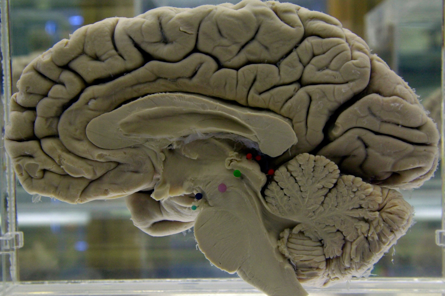 Challenging your brain helps keep it healthy. Here's how to do it