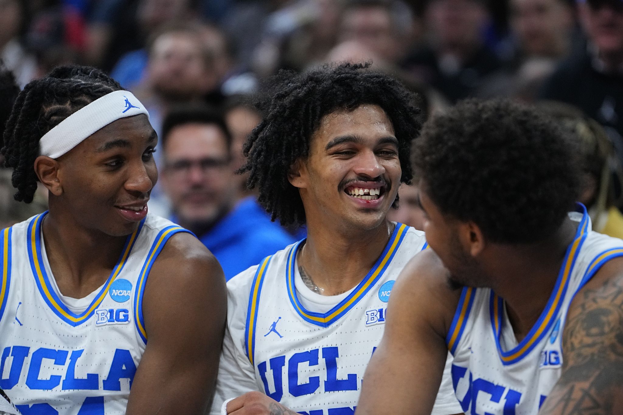Mouth madness! UCLA's Skyy Clark grins and bears it after tooth bites ...
