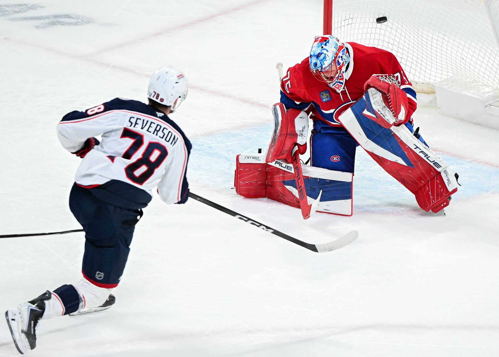 Blue Jackets defenseman Damon Severson has season-ending shoulder surgery