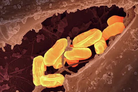 Dangerous disease 'old as the plague' hits record high in California