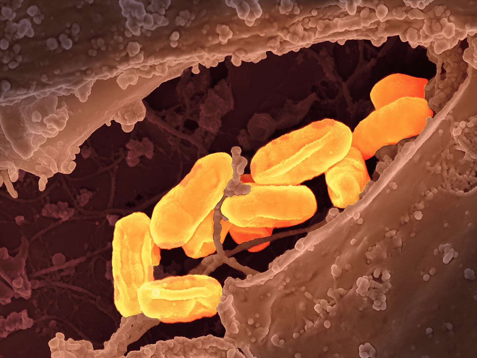 Typhus Texas: Symptoms, spread and prevention guide