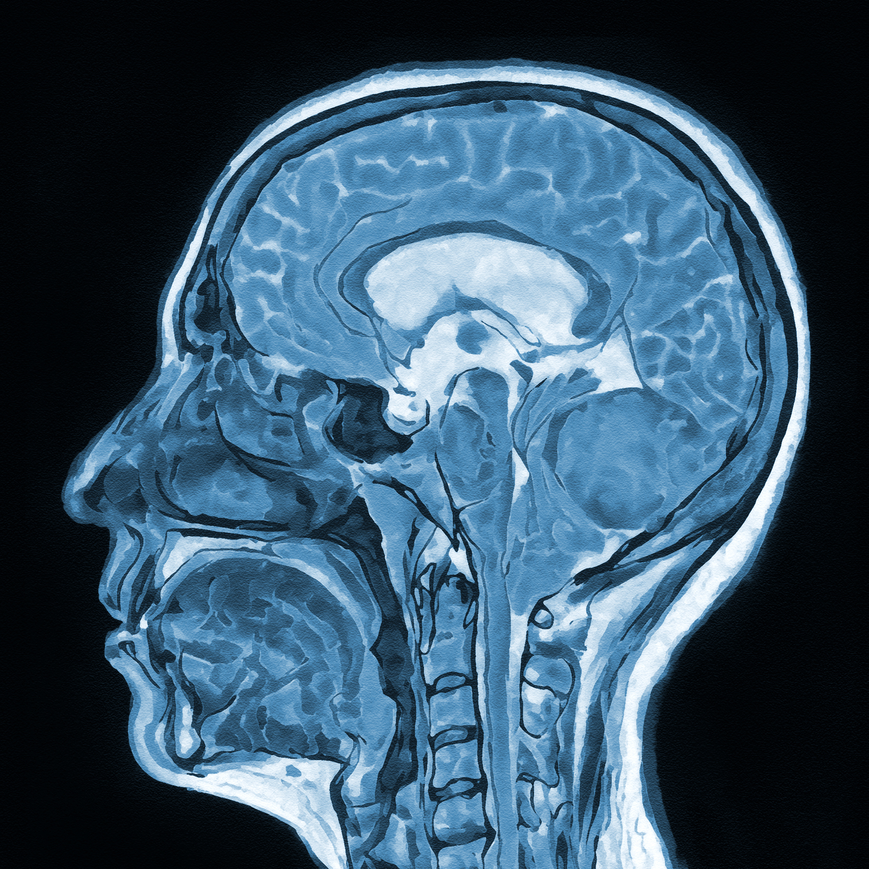 Movies opening: "Fuze," "Over Your Dead Body," "Broken Bird"