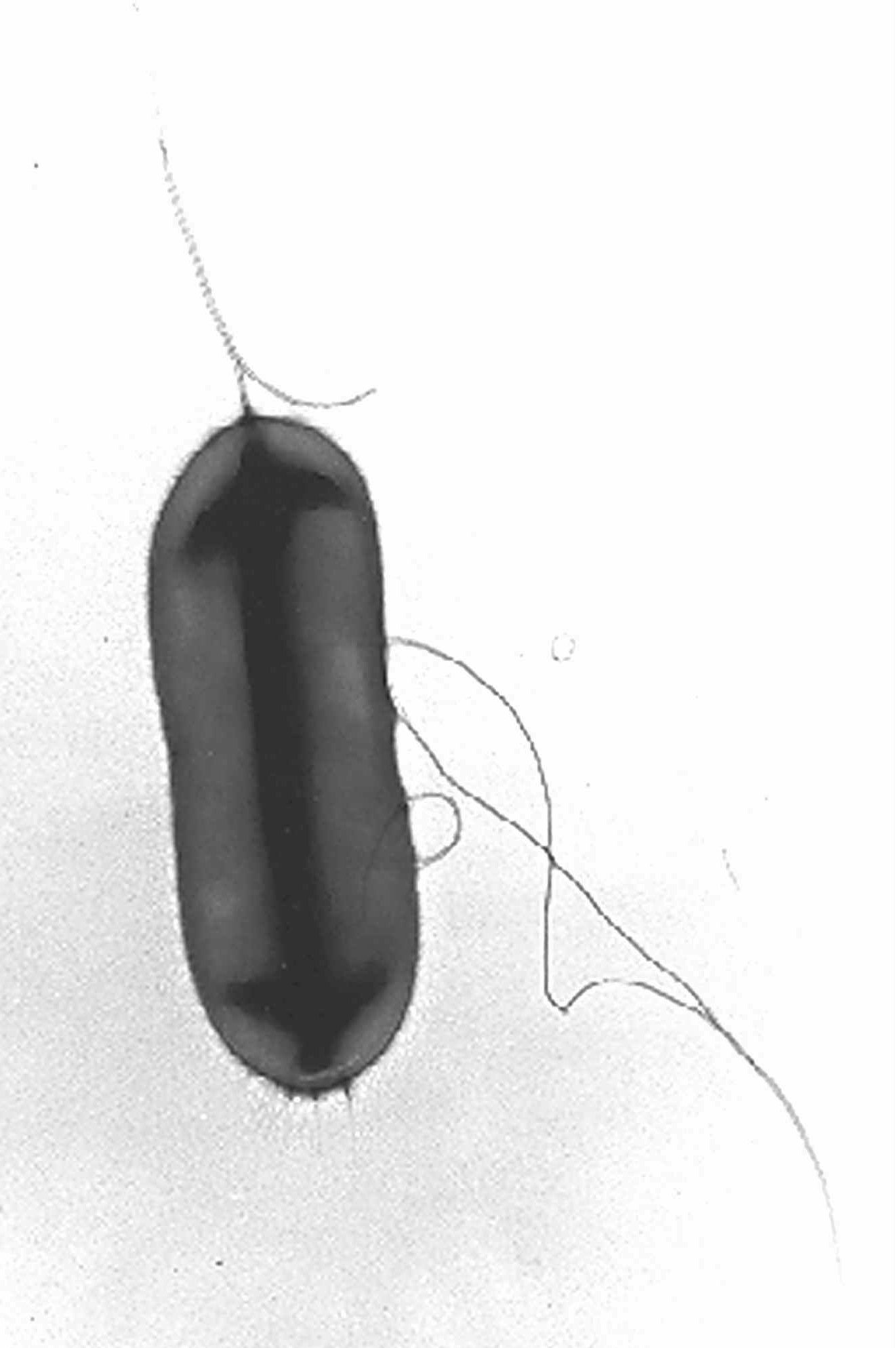USDA issues E. coli alert for beef used at the Kebab Shop