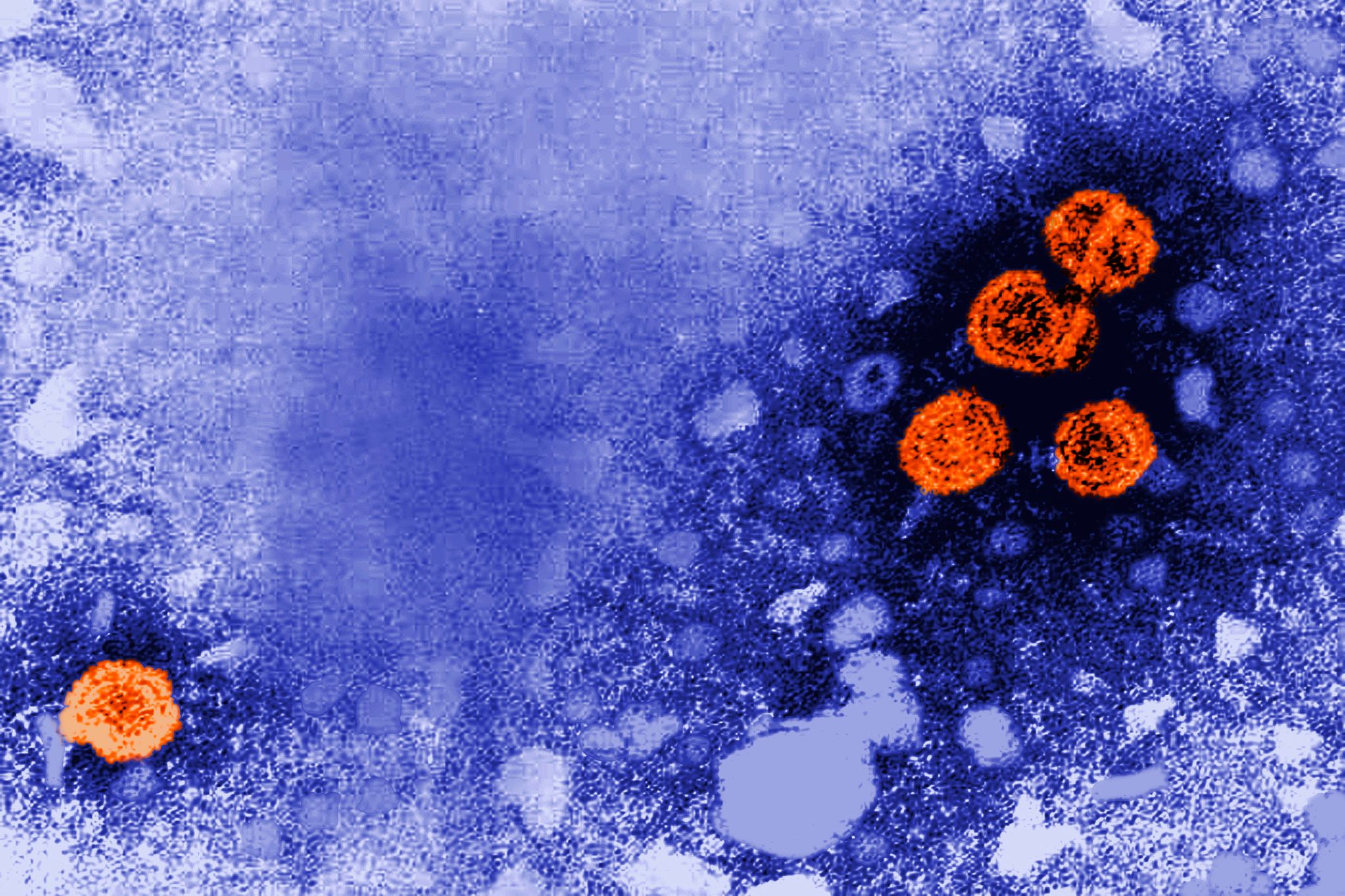 Experimental hepatitis B drug may offer 'functional cure' for some patients