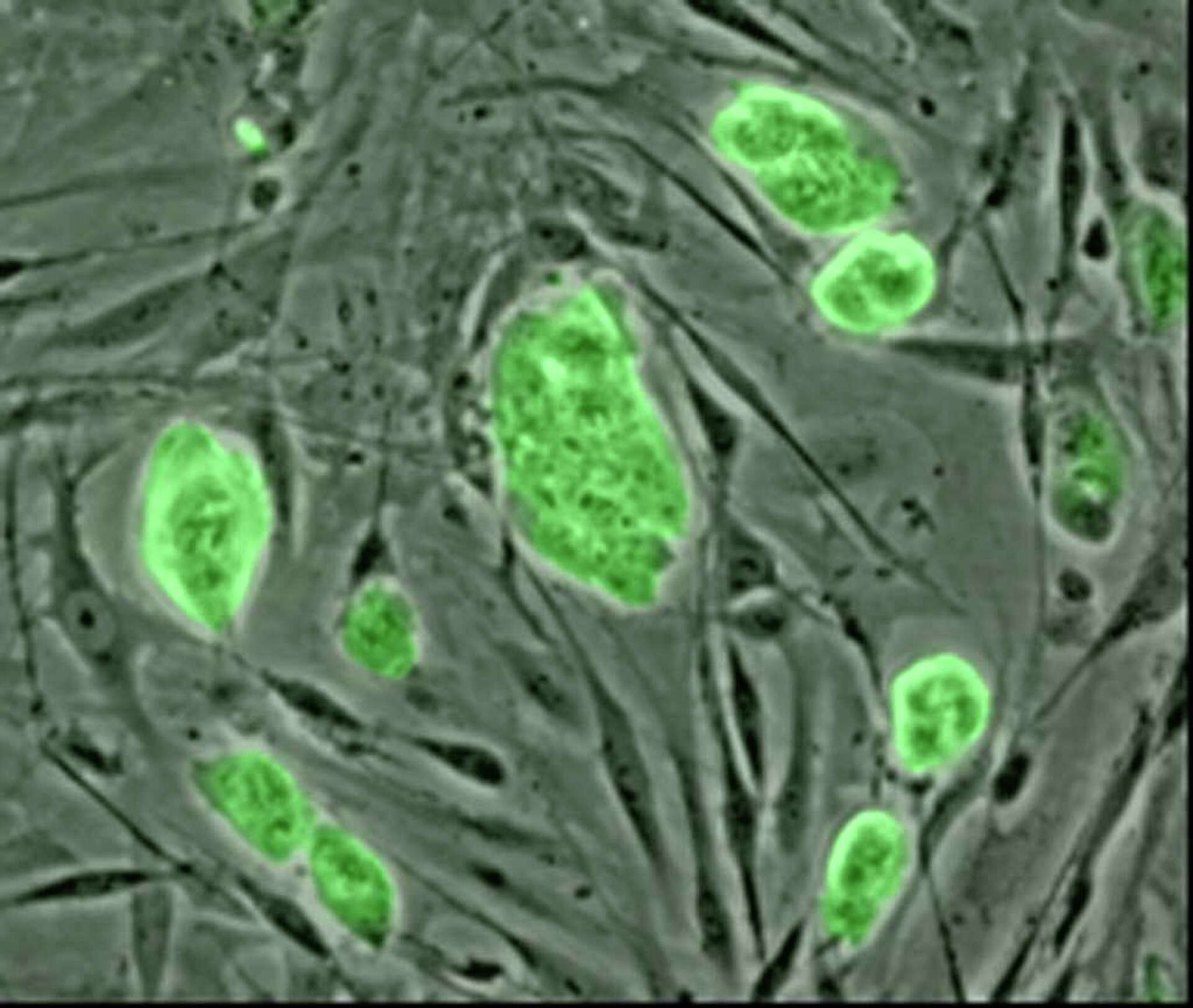 Stem cell industry's 'huge development' in Bay Area