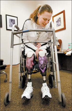 Chapter Five: Pregnant and adjusting to life without legs