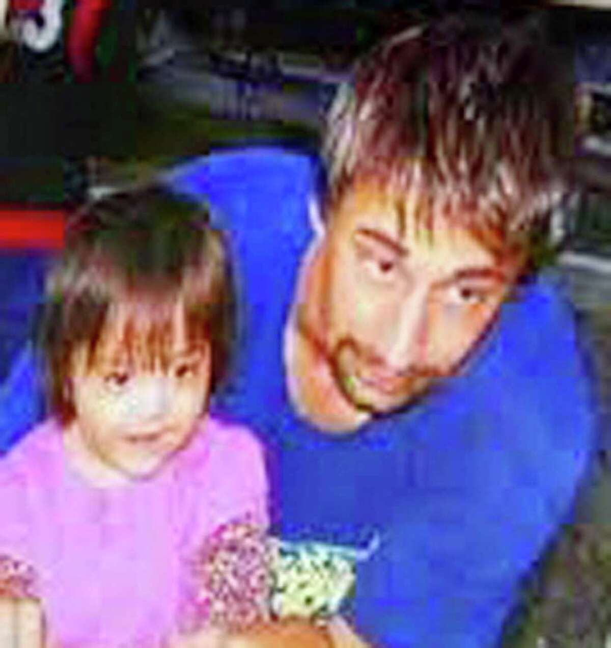 Man gets full face transplant