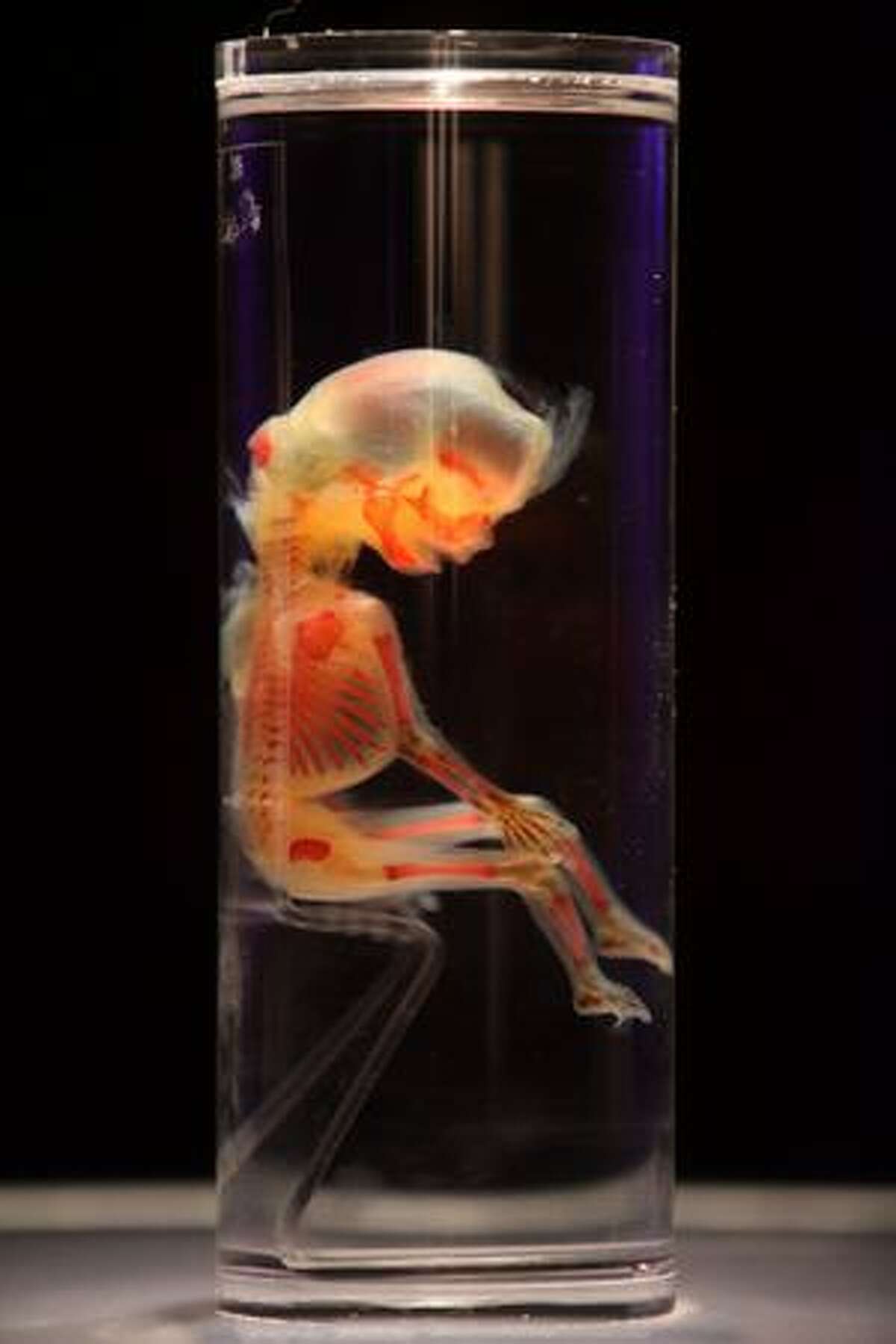 'Bodies... The Exhibition'