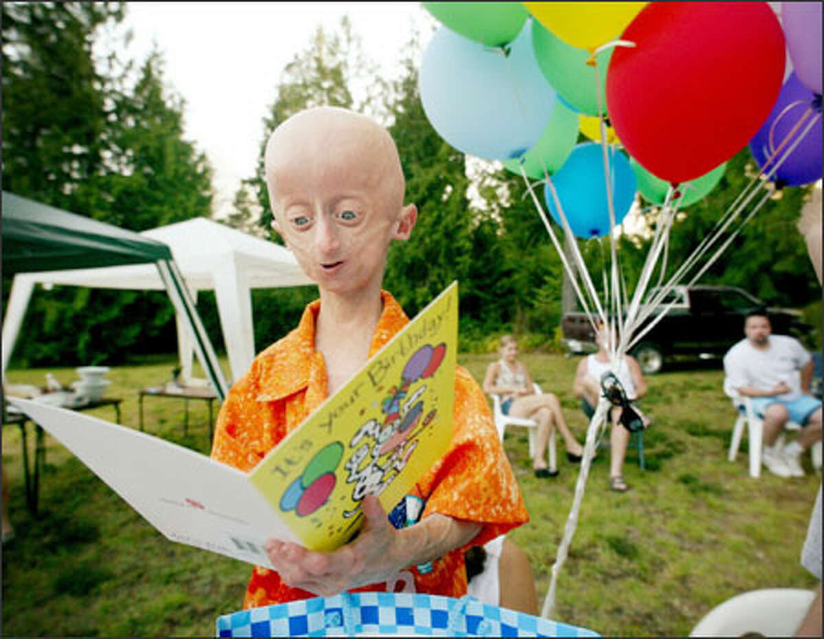 A Time to Live (Seth & Progeria)