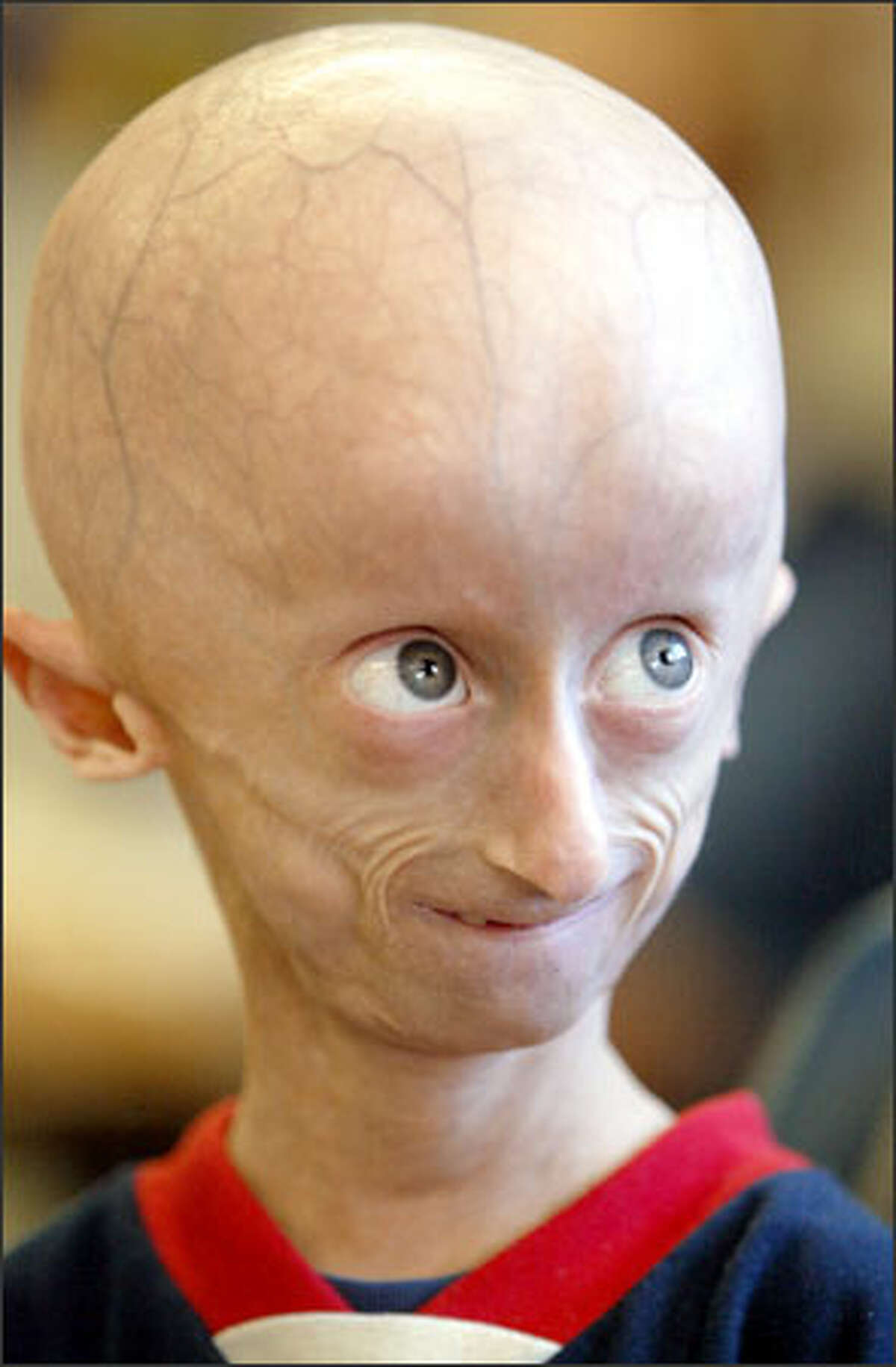 A Time to Live (Seth & Progeria)