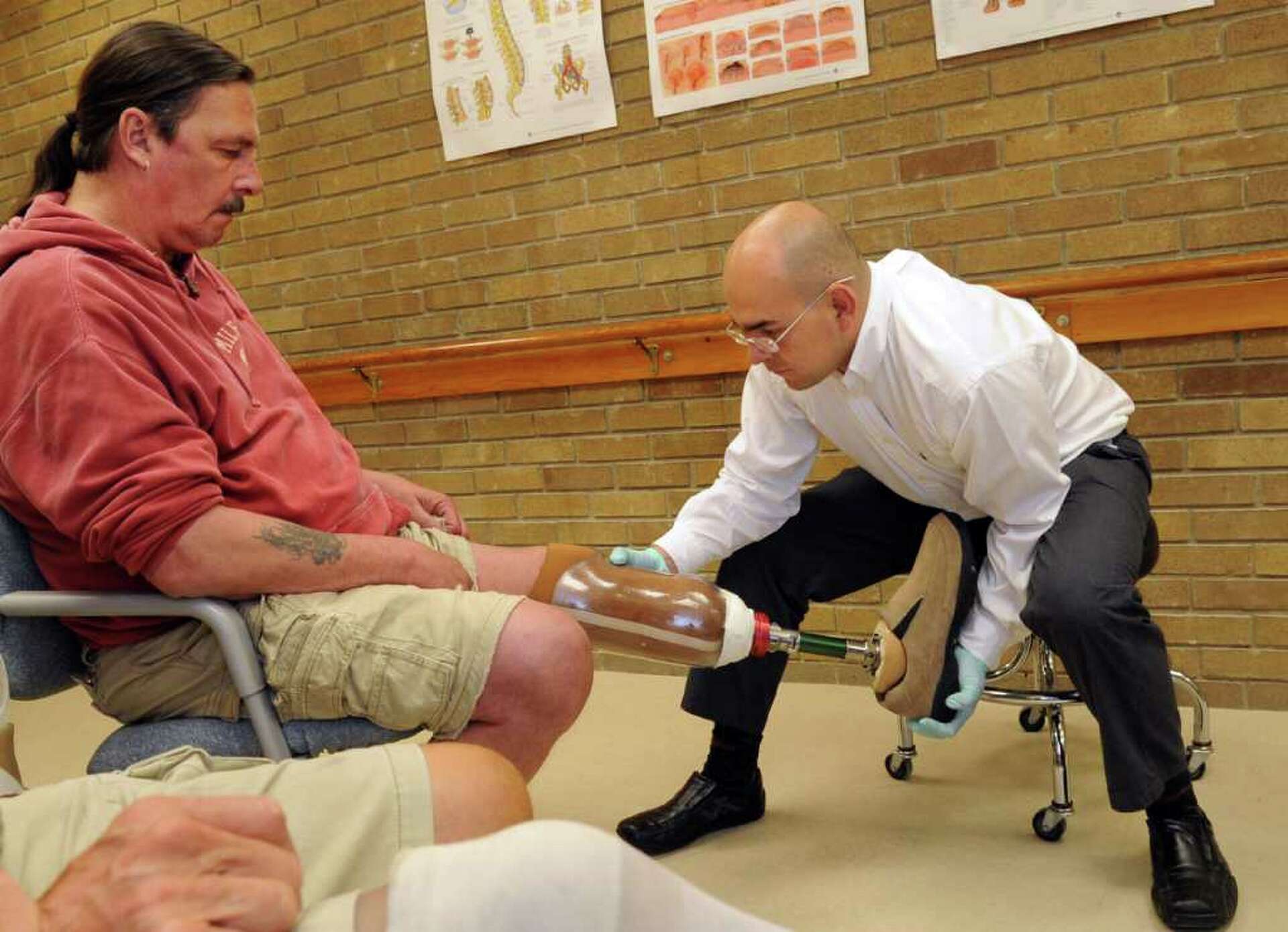 Colombia students get practical experience in fitting prosthetics