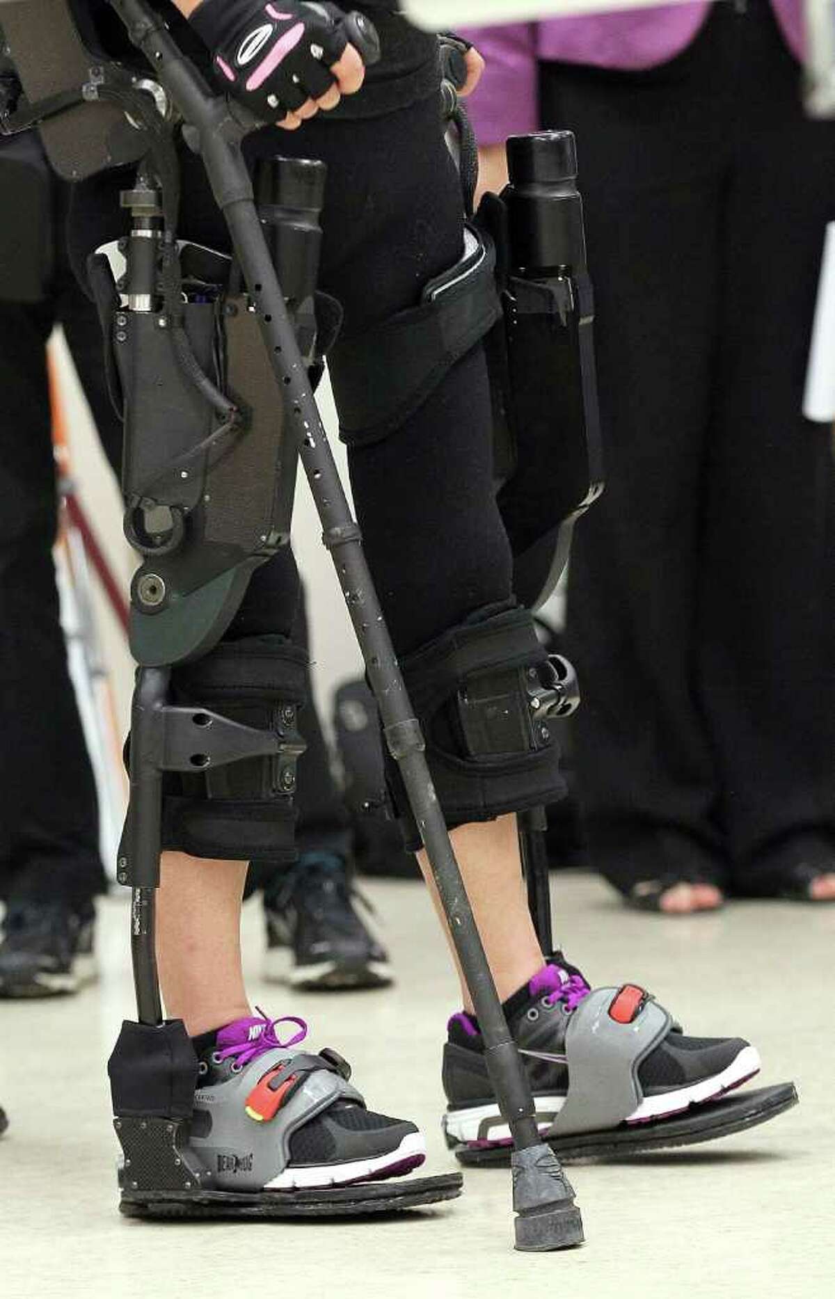 How close are bionics to a real 'Six Million Dollar Man'?