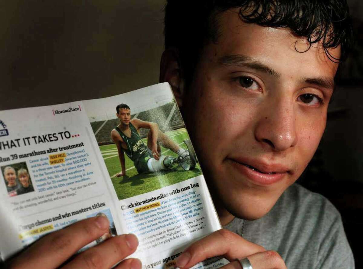 Amputee inspires audiences with story