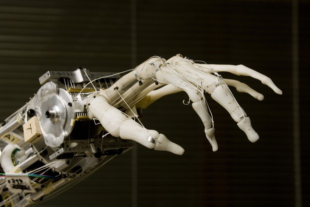 UW gets grant for developing mind-controlled robotic limbs