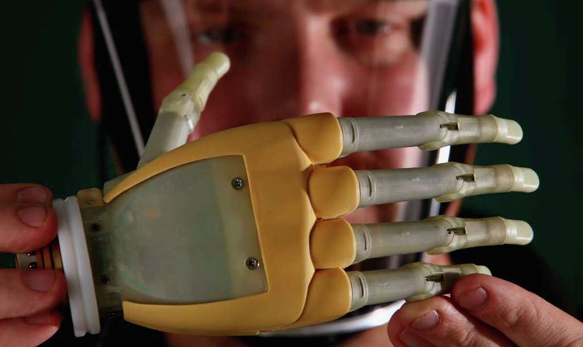 UW gets grant for developing mind-controlled robotic limbs