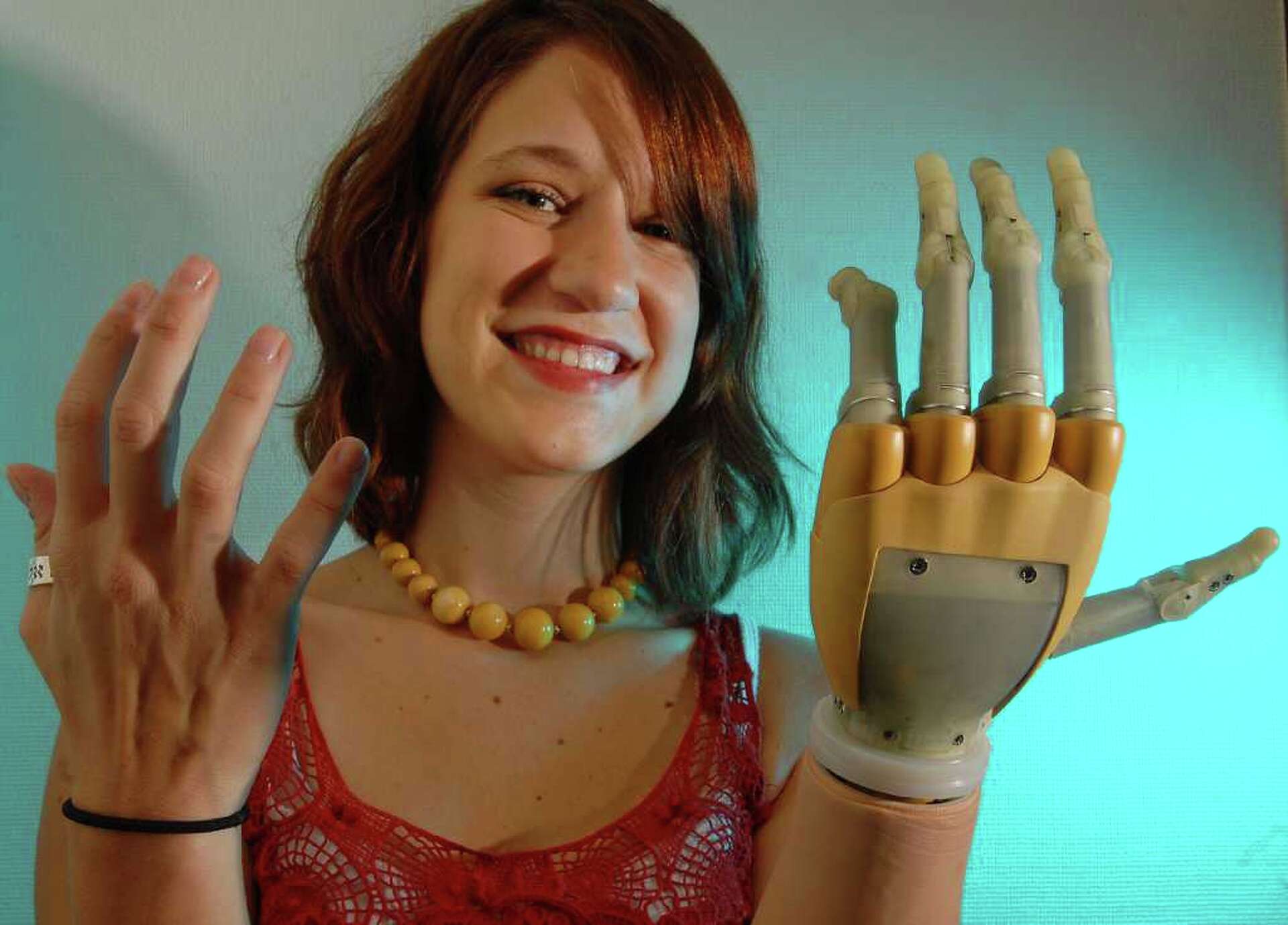 UW gets grant for developing mind-controlled robotic limbs