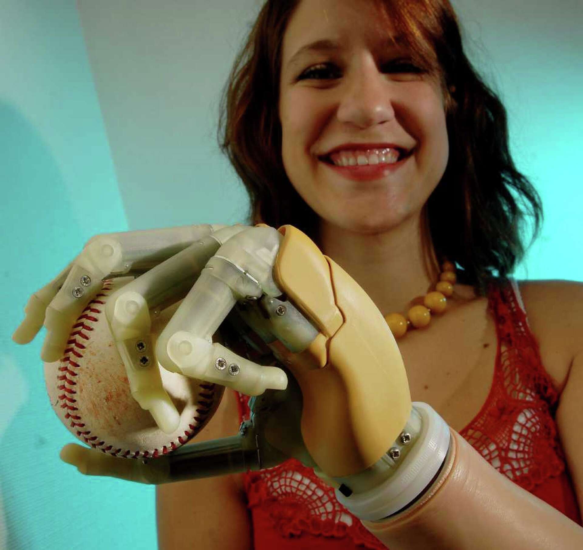 UW gets grant for developing mind-controlled robotic limbs