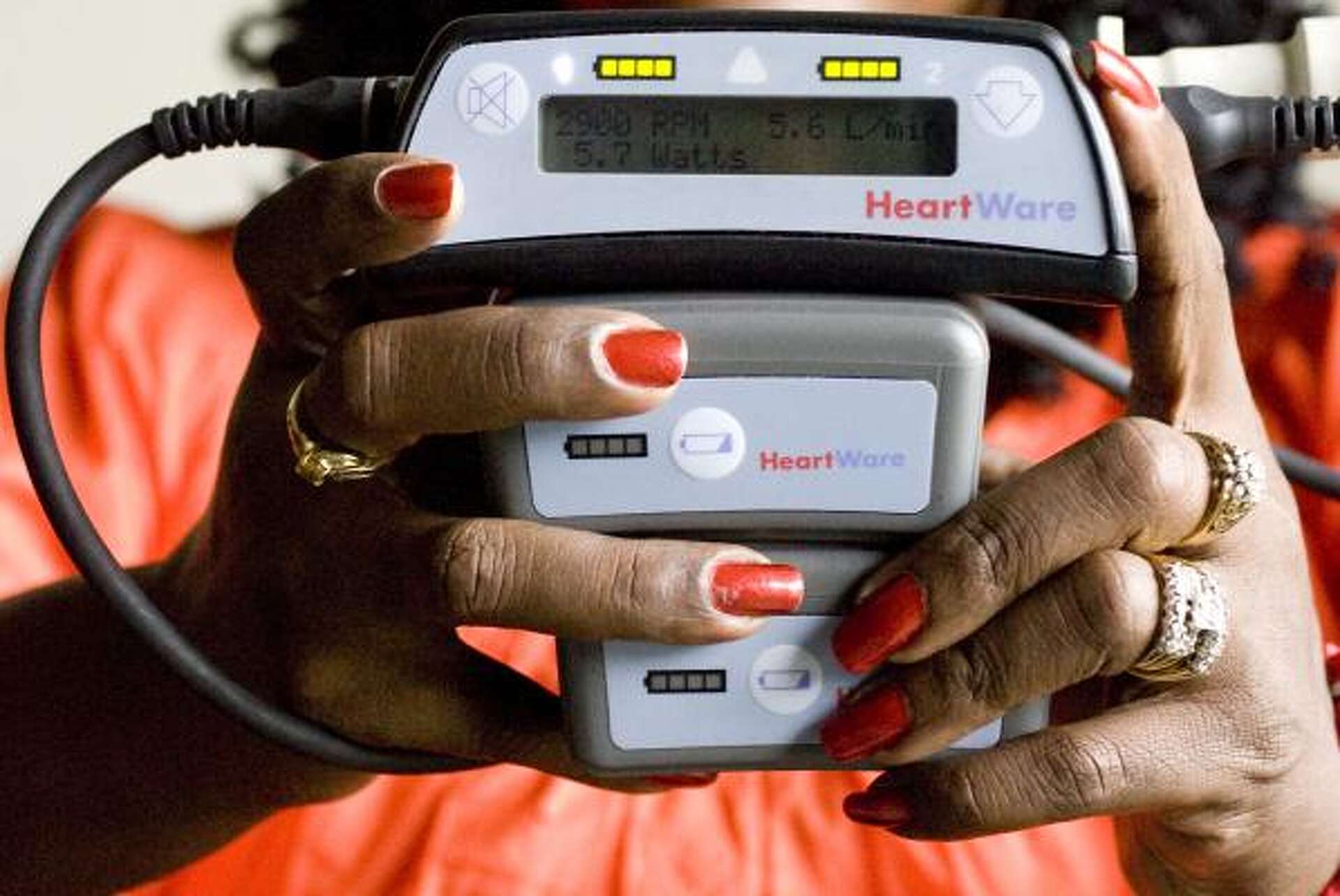 Heart pump brings a year of vigor for once-weary patient