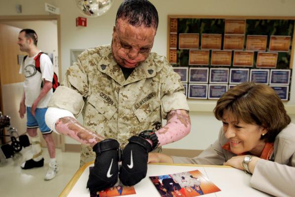 Injured Texas Marine dies after enduring 100 surgeries